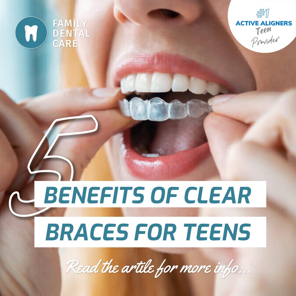 Get your teen's clear braces at Hilton Family Dental Care - HiltonVillage.co.za